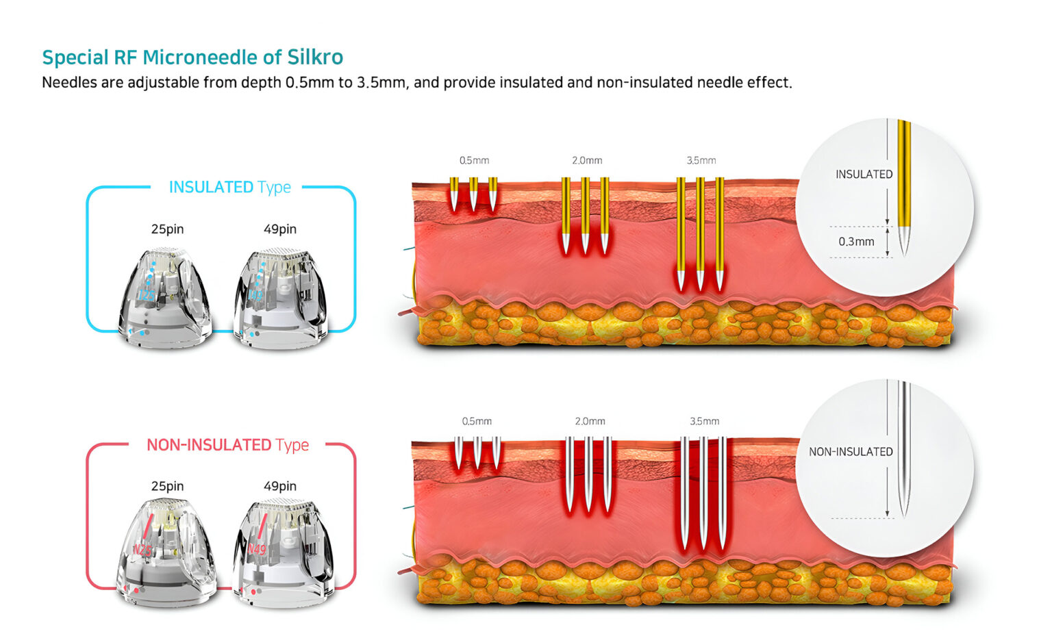 SILKRO - Inovație în Microneedling RF și Terapie cu Plasmă pentru ...